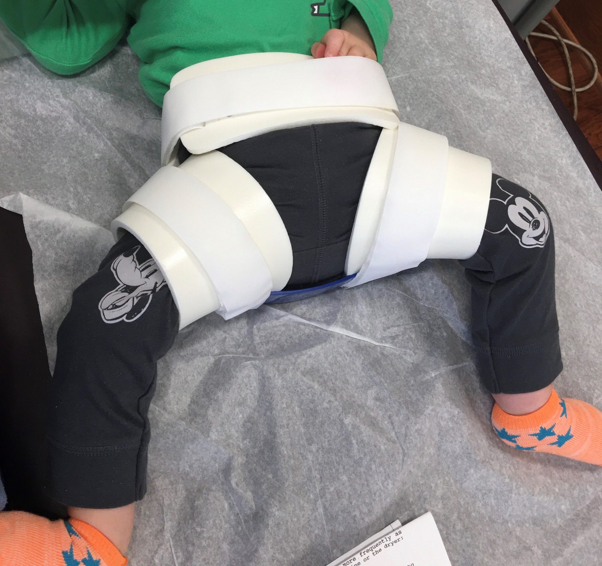 Preparing Yourself and Your Child for Hip Dysplasia: - Miles4Hips